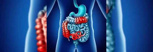 Global study reveals gut bacteria changes at the earliest stages of ...